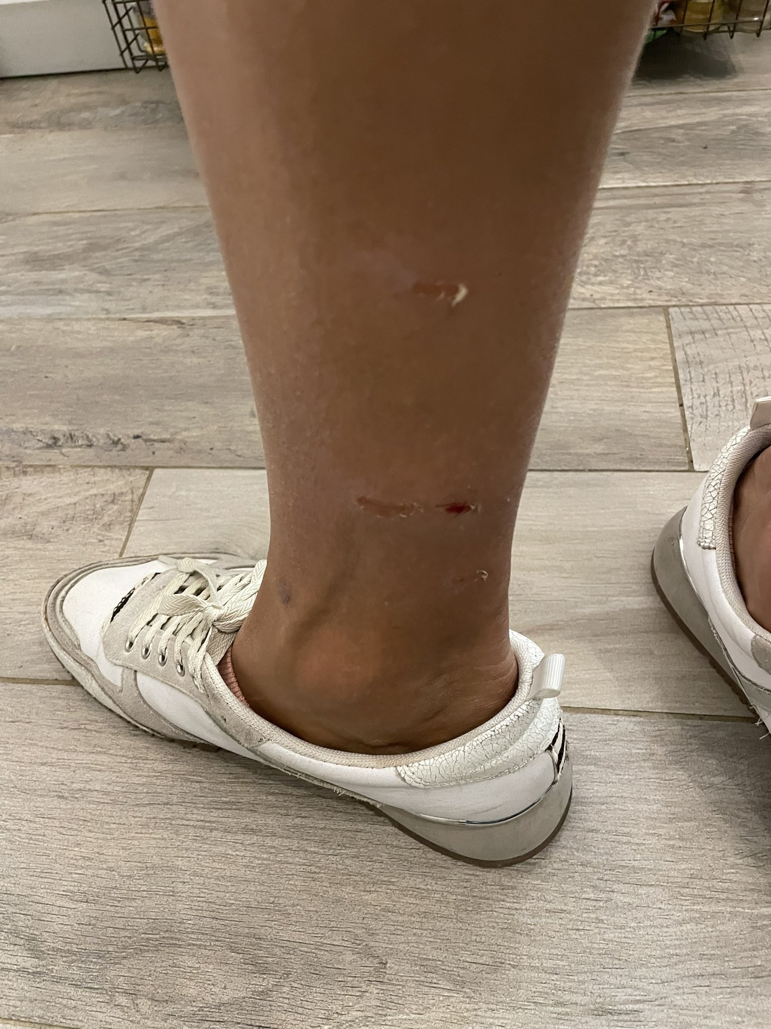 The Templar On Twitter Вечерва жена ми ја нападнало улично куче кај град скопје во парк