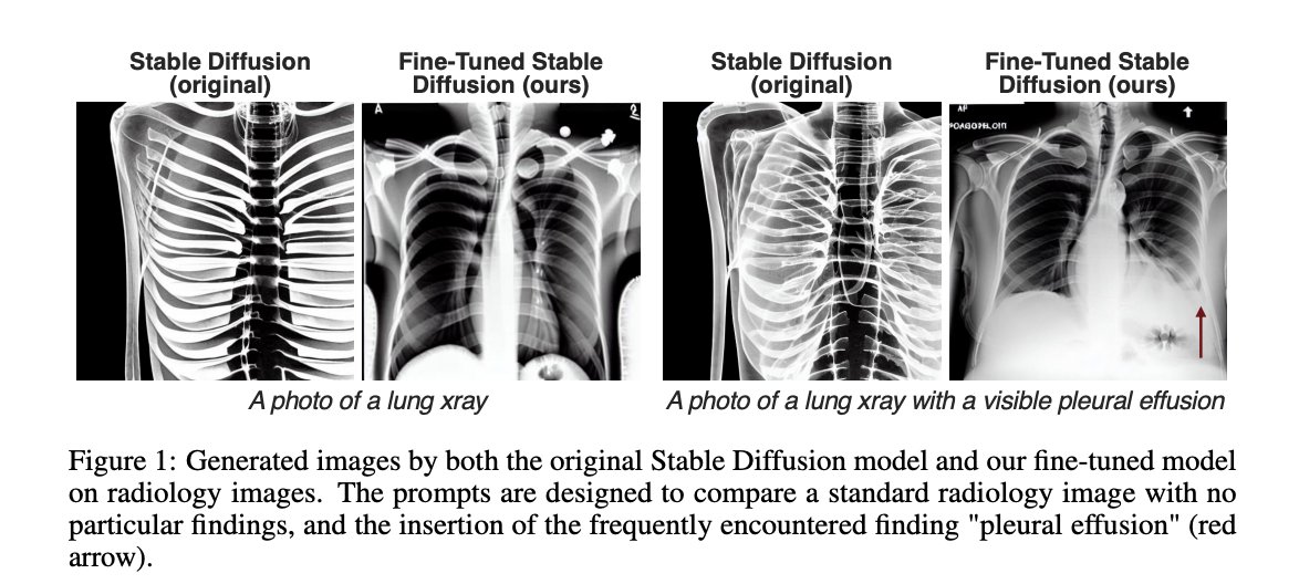 AK on Twitter: "Adapting Pretrained Vision-Language Foundational Models to Medical Imaging ...