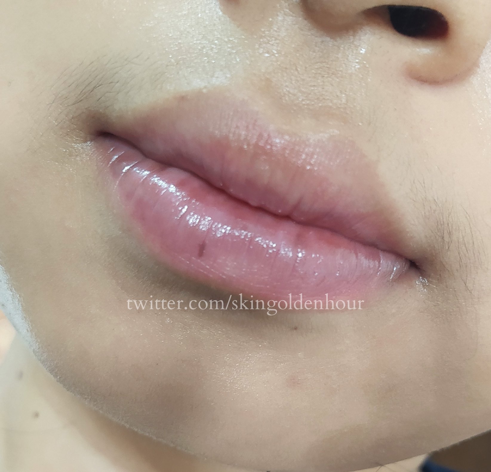 santi on Twitter: "CARA MENGATASI BIBIR HITAM MENJADI GLOW UP!! #racuninskincare https://t.co ...