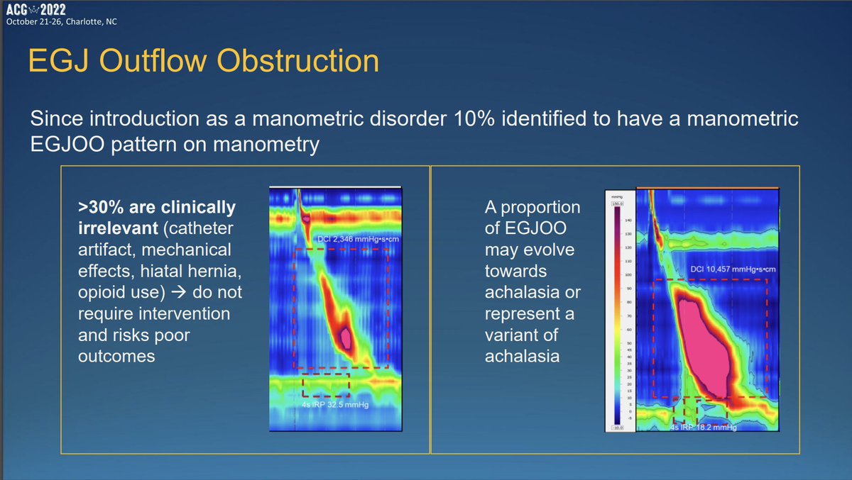 Non-#achalasia #motility disorders of the #esophagus with ...