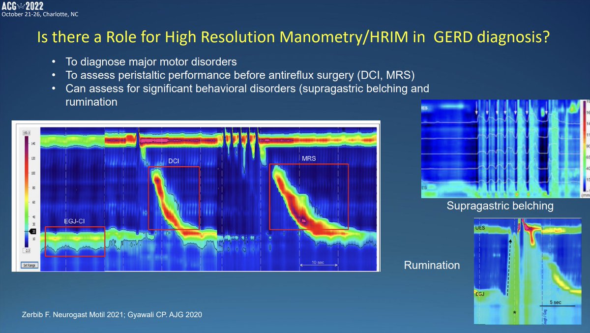 Updates in #GERD with @FeliceSchnoll #MedTwitter #GITwitter #motility # ...