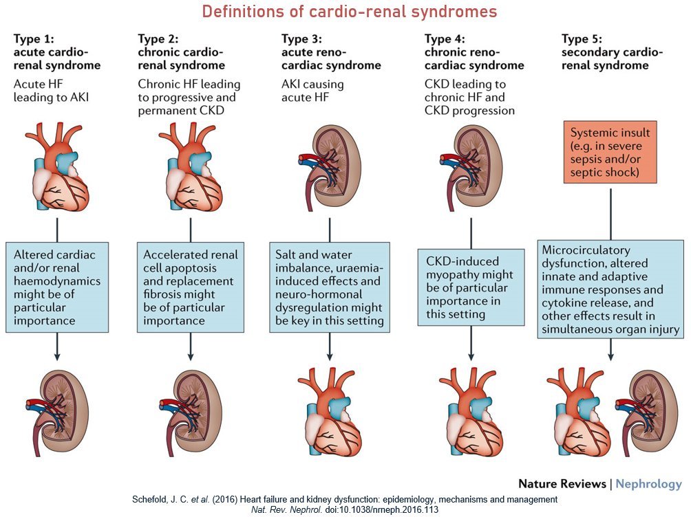 5 subtypes of #cardiorenal syndrome exist defined according to the ...