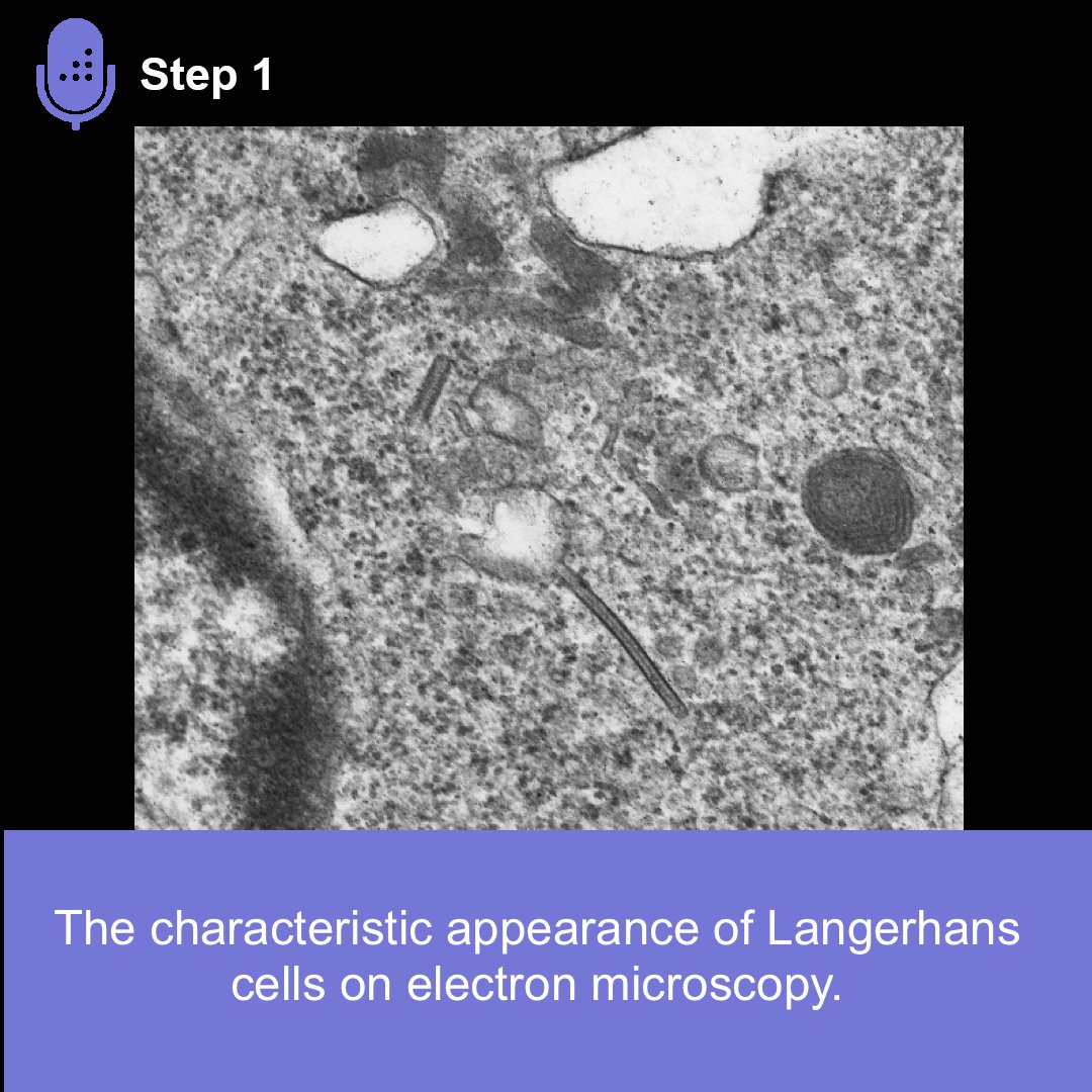 Langerhans Cells Electron Microscopy