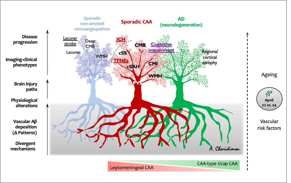🤿🧠 Cerebral Amyloid Angiopathy (CAA) - A 'Twitter' Review 1) What is ...
