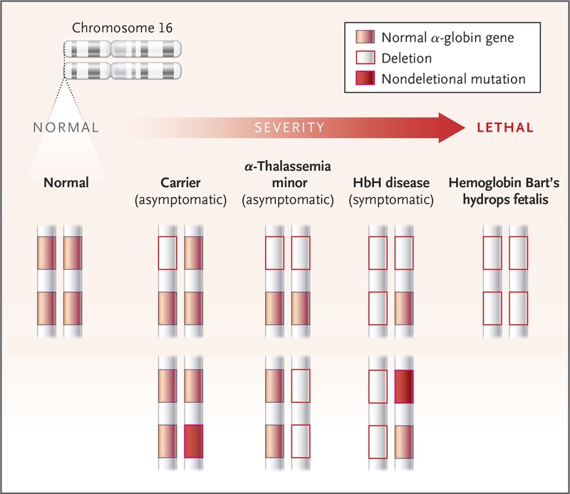 ?Alpha Thalassemia Here by @Biotech2k1 – Unroll Thread – We unroll ...