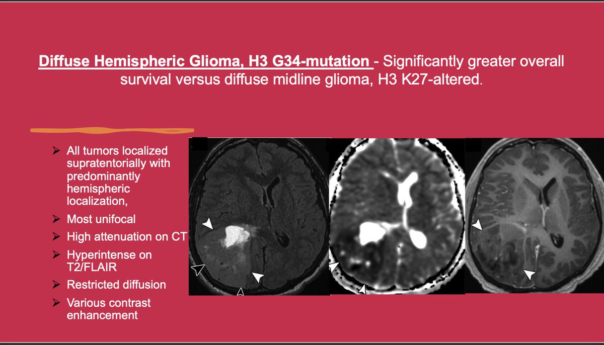 Get updated information on the 2021 WHO Classification of CNS Tumors by ...