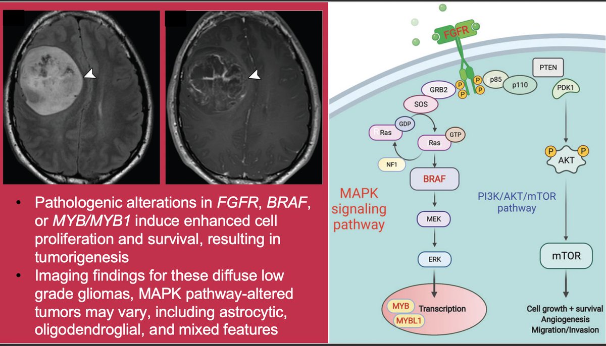 Get updated information on the 2021 WHO Classification of CNS Tumors by ...