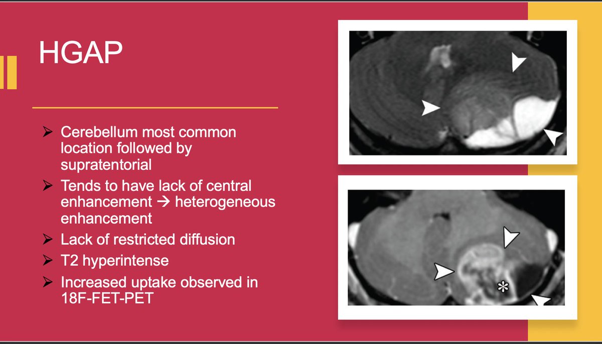 Get updated information on the 2021 WHO Classification of CNS Tumors by ...