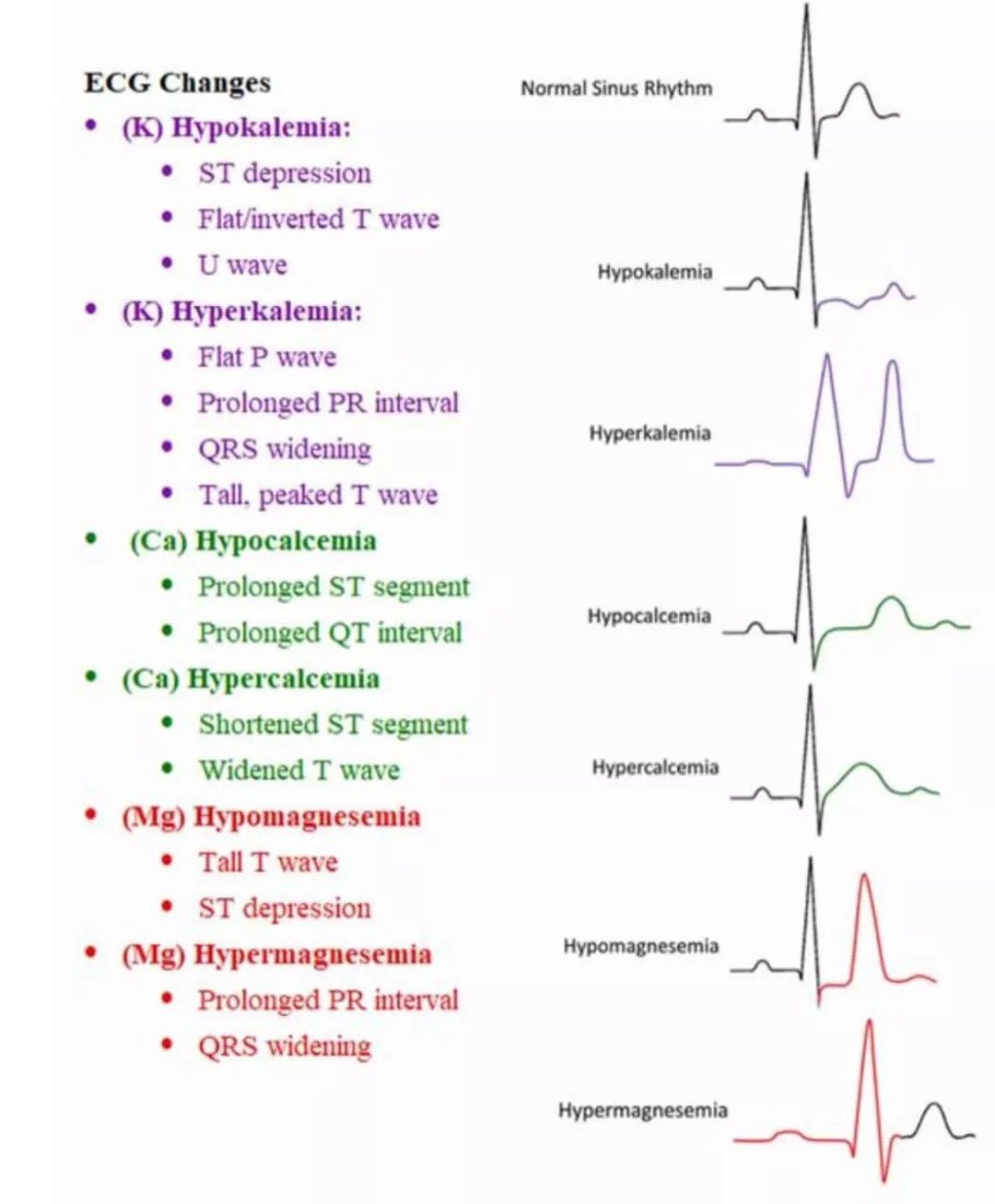 Top Biomedical Science on Twitter: "ECG changes @NurseHann100 #TipsForNewDocs #MedEd #MedTwitter ...