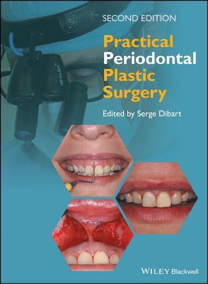 [ePub] download Practical Periodontal Plastic Surgery BY Serge Dibart Online New Format / Twitter