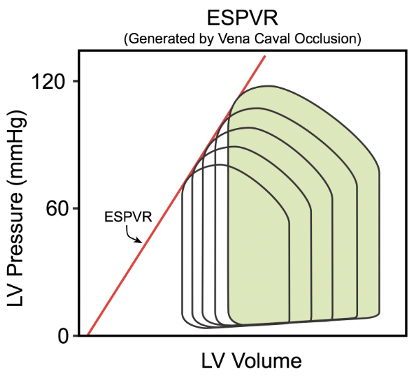 Do you ️ hemodynamics? How about PV loops? Here is Part I of our ...