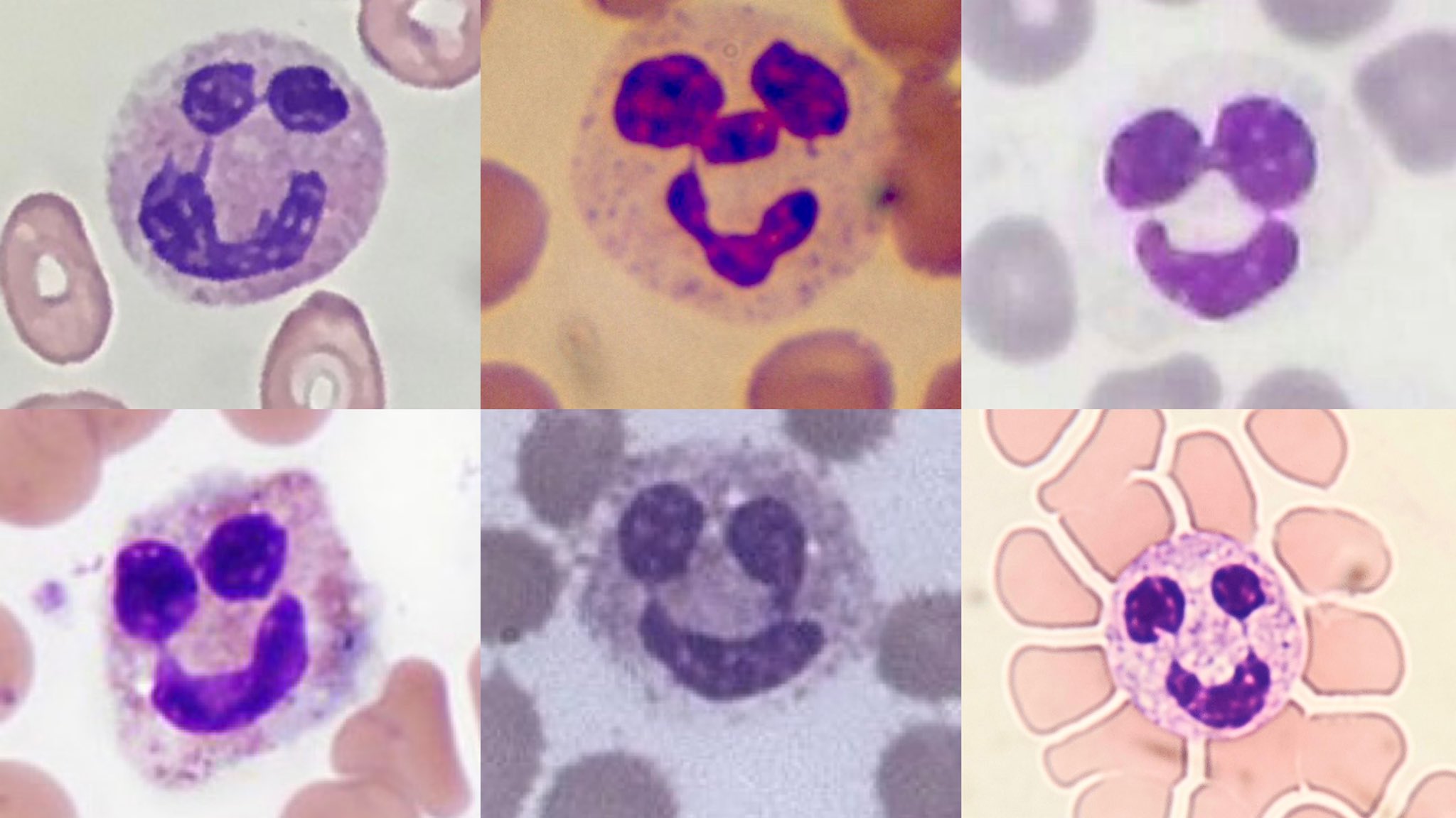 Toxic Neutrophils