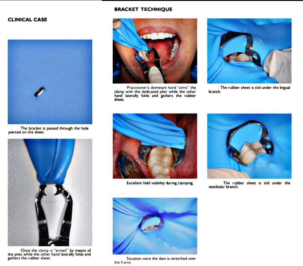 كيف نركب rubber dam #Dental_by_Hadeel - Thread from هديل 🕊 @Hadeel7m ...