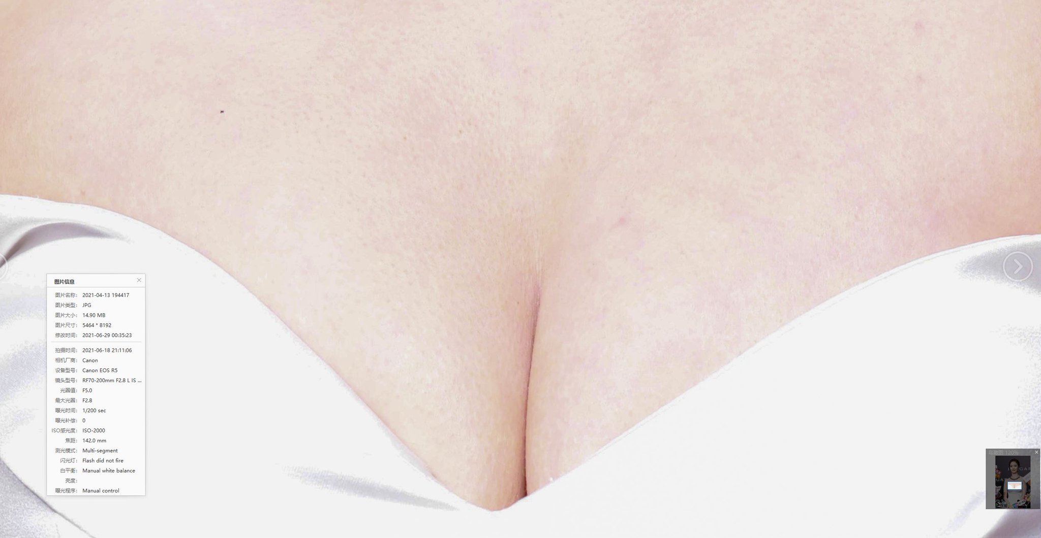 明星生图 长期网址 sc8.life on Twitter: "佟里丫（第3机位 ） 超清晰面部+美脚+性感美乳 放大美乳皮肤的细节超清 120张 3.88r自取`~ https://t.co ...