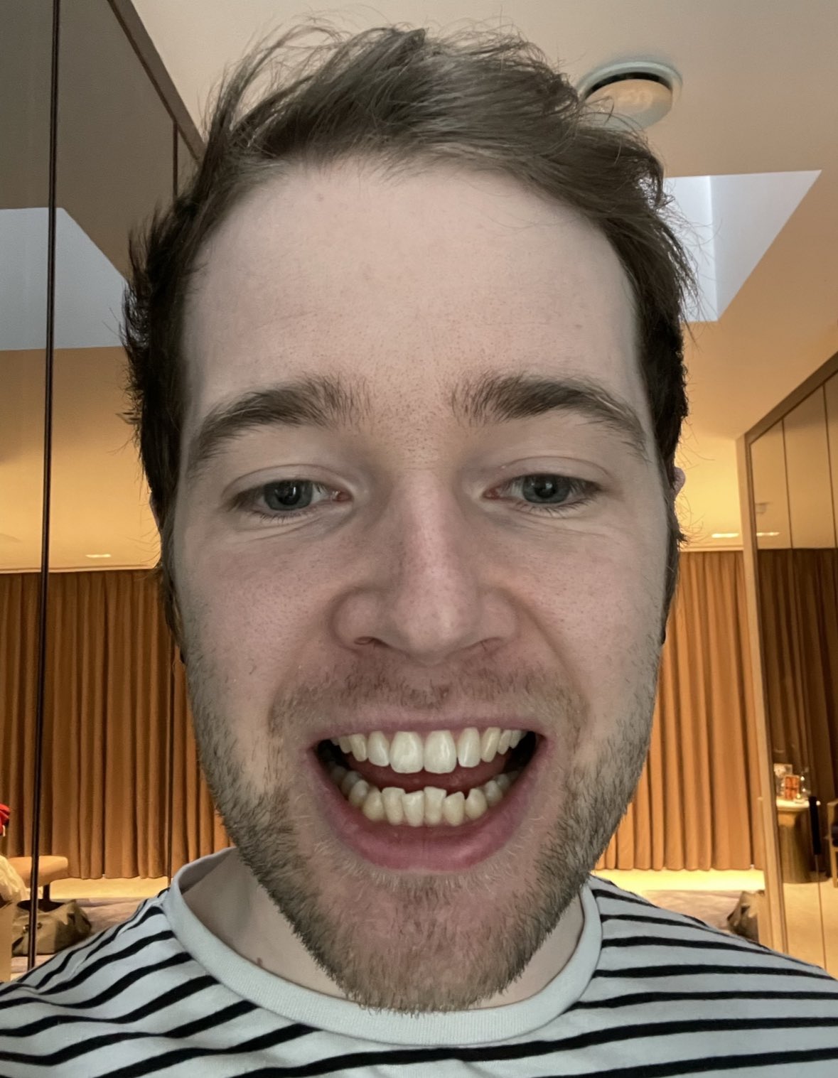 ᴅᴀɴᴛᴅᴍ💎 on Twitter: "After 9 months of work, my teeth are finally straight! 🙌🏻 https://t.co ...
