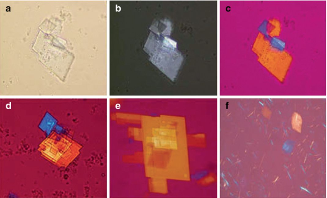 Polarized Cholesterol Crystals
