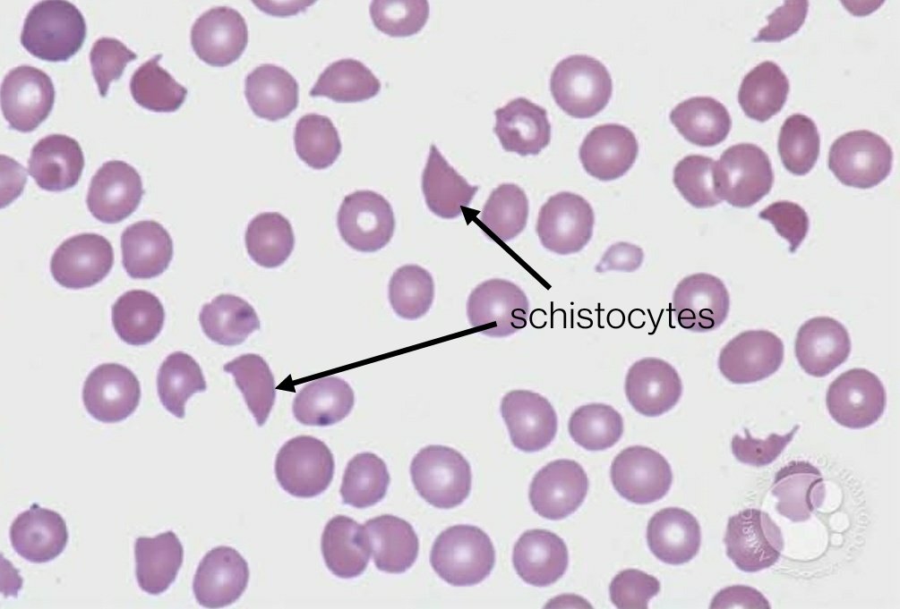 You are a young #medicine resident, again 🤣 You are called in for a ...