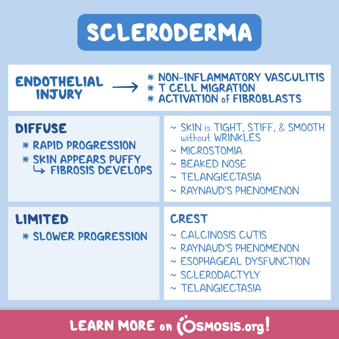 Osmosis on Twitter: "Scleroderma is a rare autoimmune disorder in which normal tissue is ...
