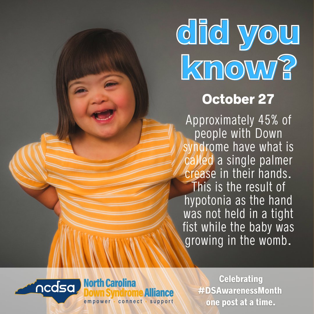 Hypotonia Down Syndrome