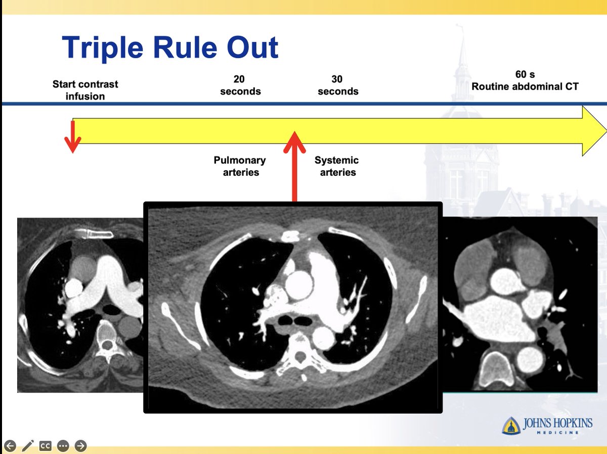 Thread by @PamelaJohnsonMD on Thread Reader App – Thread Reader App