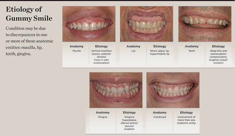Got more gums than a pack of trident? We all have a unique blend of ...