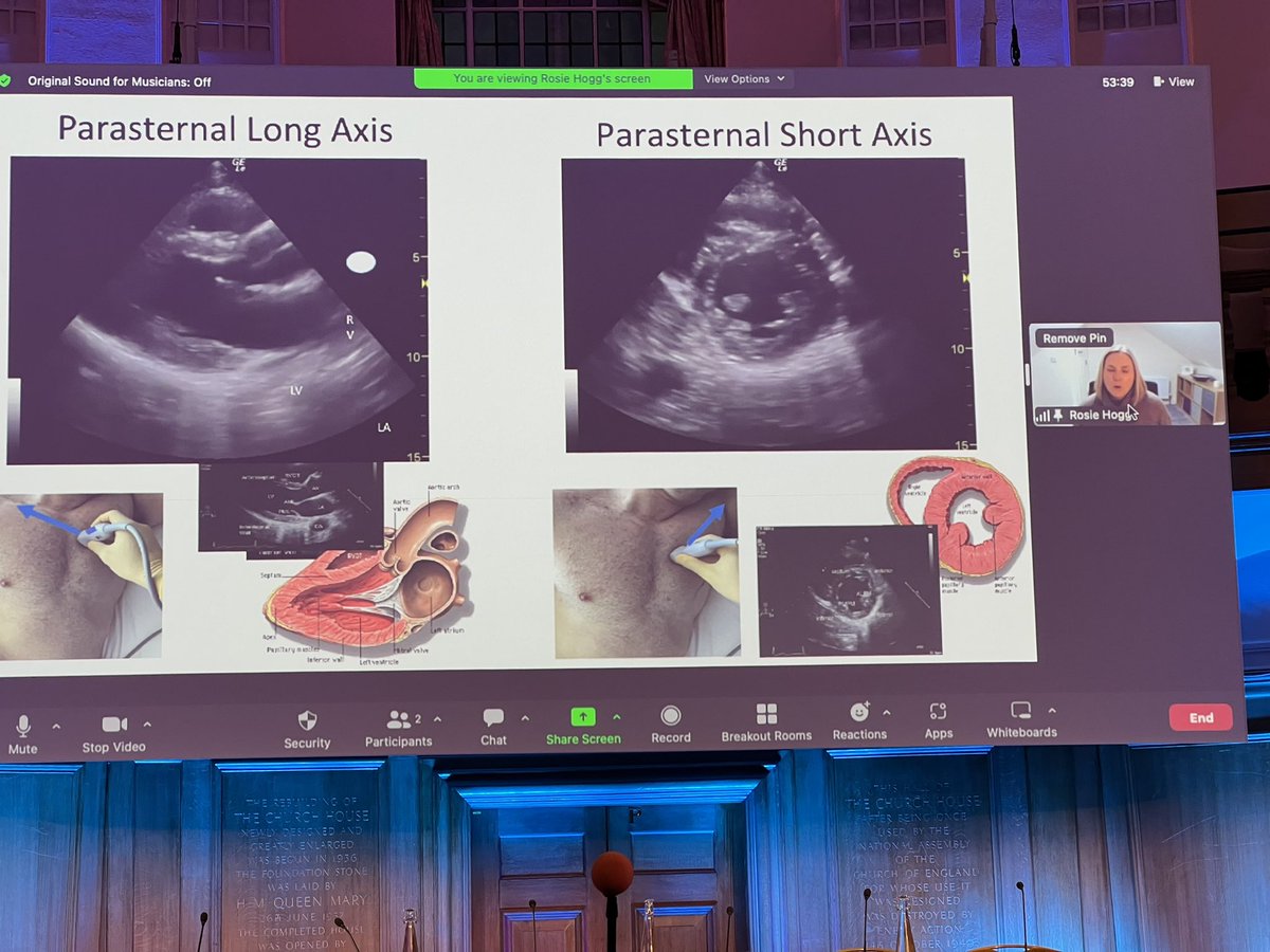 Thread by @OBsleepmerchant on Thread Reader App – Thread Reader App