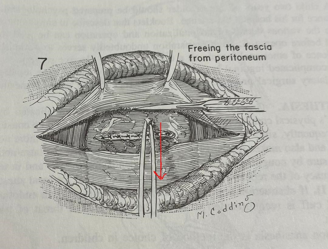 🧵regarding the principles of 'traction' and 'countertraction'. These ...