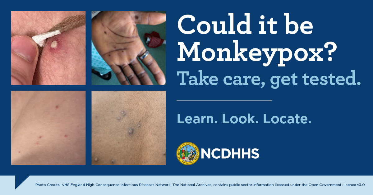 NCDHHS on Twitter: "Vaccines are available for people with known or suspected exposure. You ...