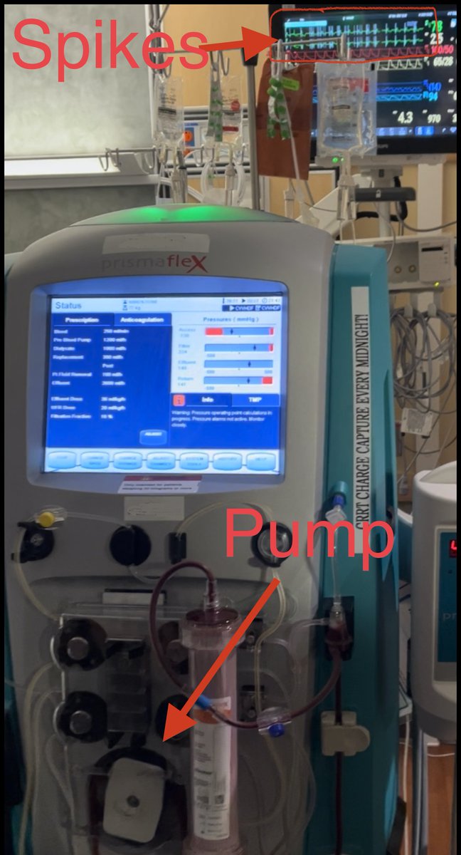 Here’s a fun ICU puzzle: what is causing this crazy spiking pattern on ...