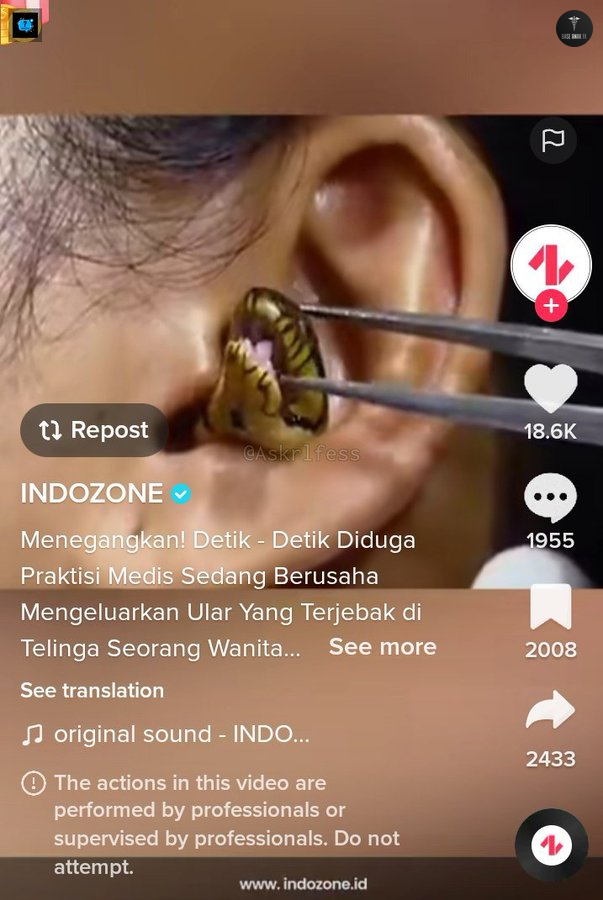 ⚕️Base Anak FK | Open DM📩 on Twitter: "Corpal telinga dok, but wait..... https://t.co/aGSaRtpSAU ...