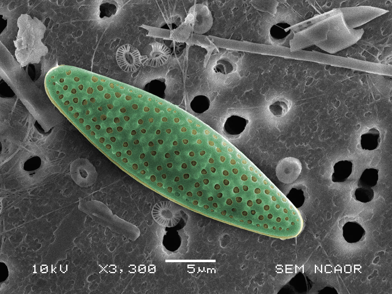 Paramecium Under Microscope 1000x