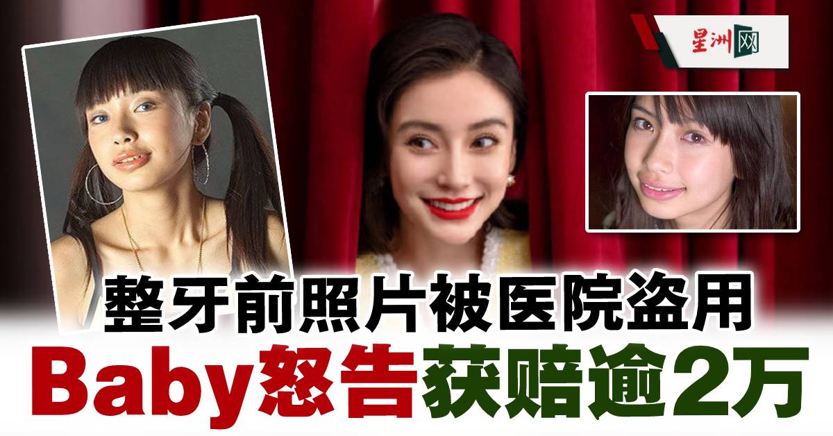 Sin Chew Daily 星洲日報 on Twitter: "院方还须公开发表道歉声明。 #Baby #Angelababy #星洲日报 #sinchew https://sinchew ...