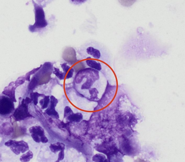 Matt Xi Luo, MD on Twitter: "What kind of cell is this? Wrong answers only https://t.co ...