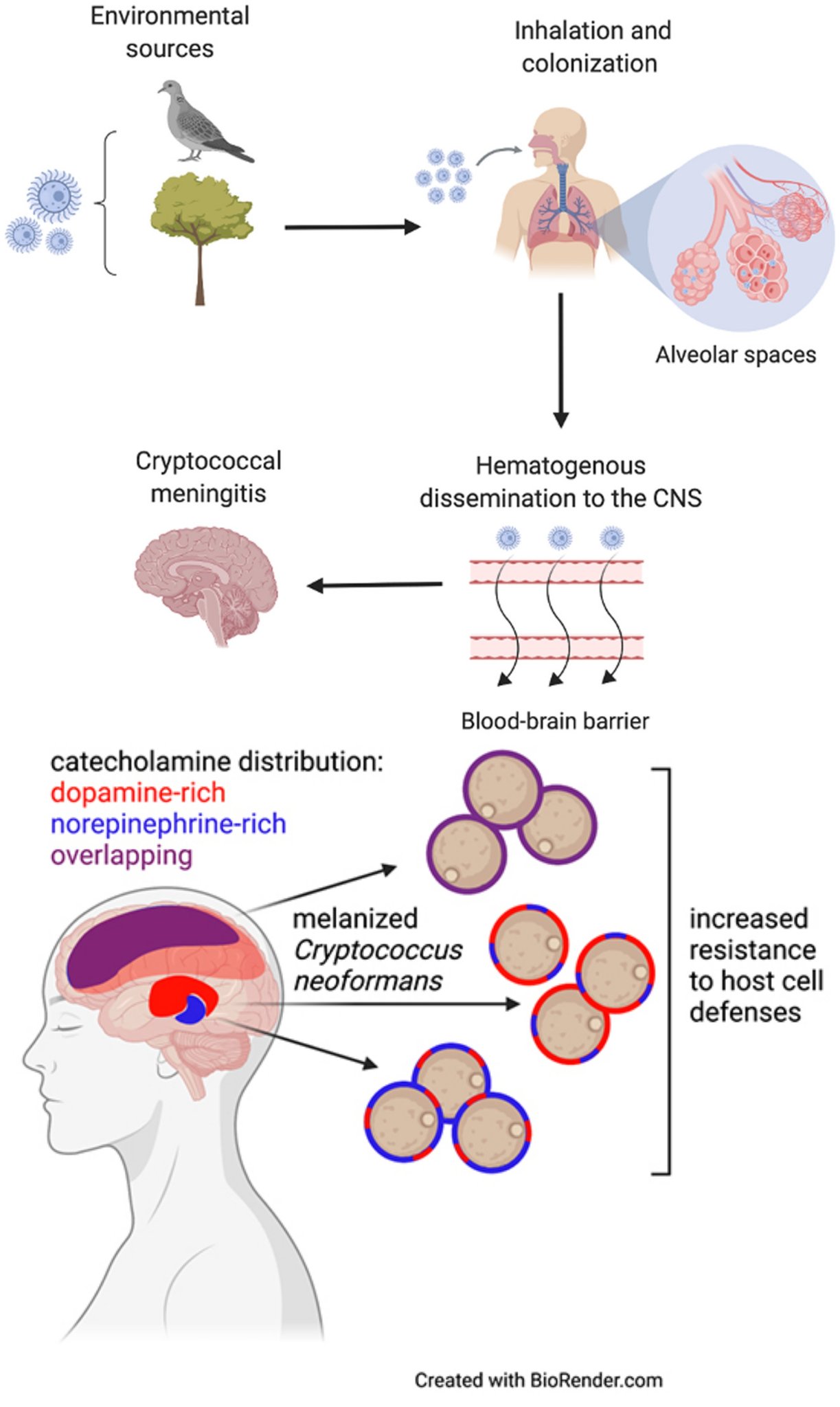 Cryptococcus Neoformans Meningitis