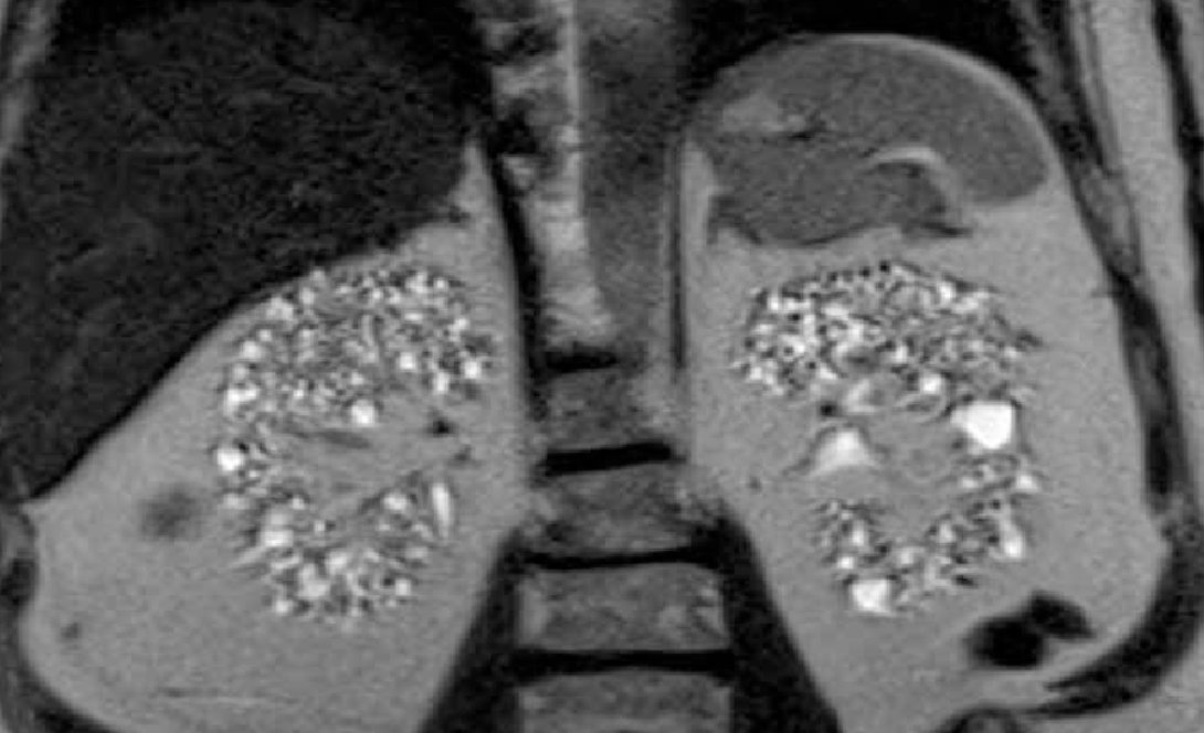 Radrounds Radiology Network Radrounds Twitter