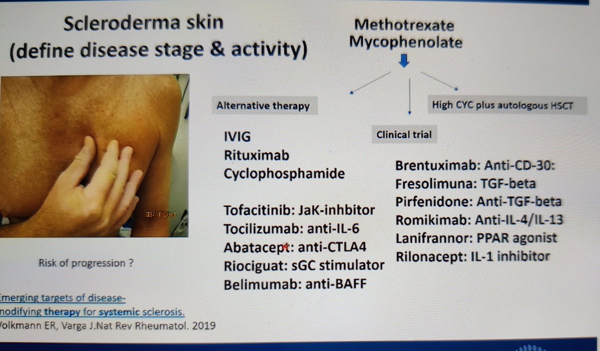 Philip S Hench memorial lecture: Scleroderma 2022 by Prof Fredrick ...