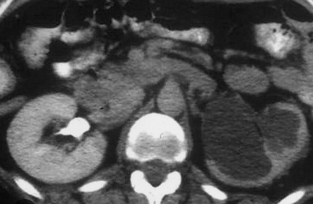 Radrounds Radiology Network Radrounds Twitter