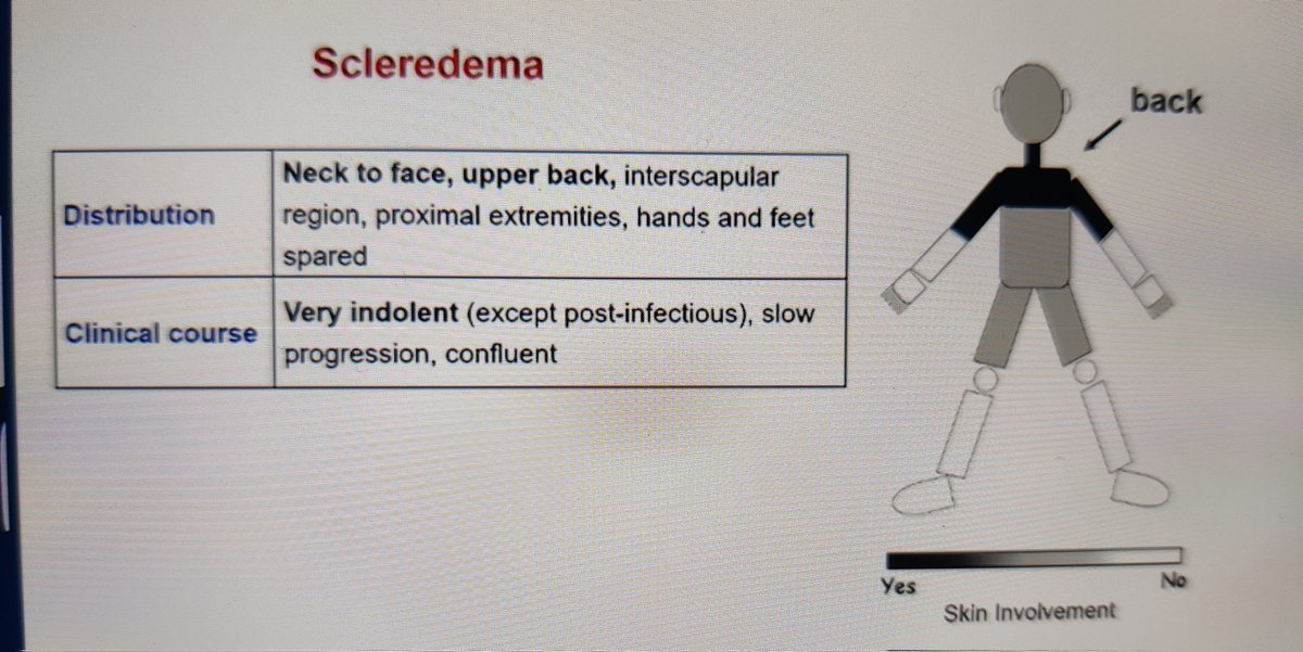💭 of #myositis mimics if ABSENT 🔸Skin rash 🔸Other extra muscular ...