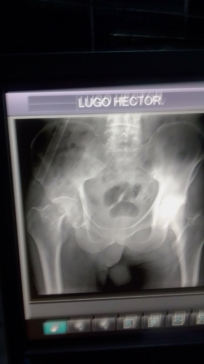 hayleth on Twitter: "RT @EdecioFeliche: Buenos días otra semana sin ningún resultado ya tenemos ...