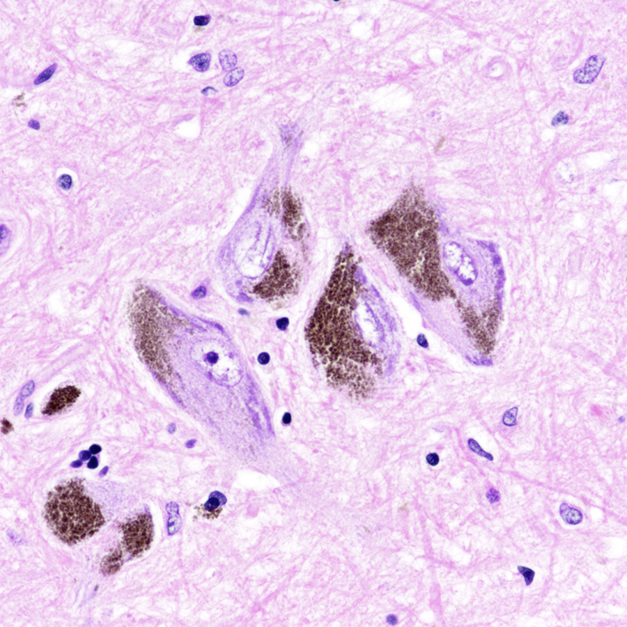 Substantia Nigra Histology