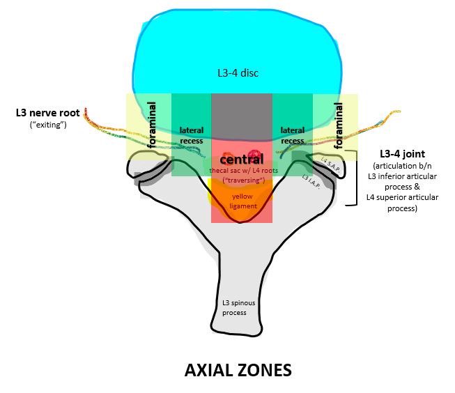 Thecal Sac Lumbar Spine
