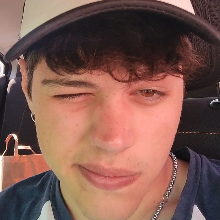 ☃️𝙵𝚎𝚍𝚍 𝙶𝚛𝚊𝚢𝚜𝚘𝚗™ on Twitter: "face reveal pa los news😹🔥 https://t.co/eRH9og8Scw" / Twitter