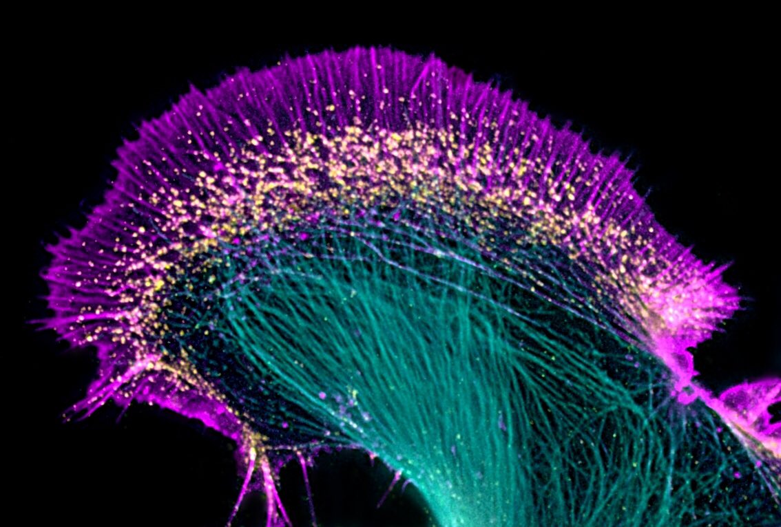 Dylan Burnette on Twitter: "Neuronal growth cones from neurons isolated from a giant sea slug ...