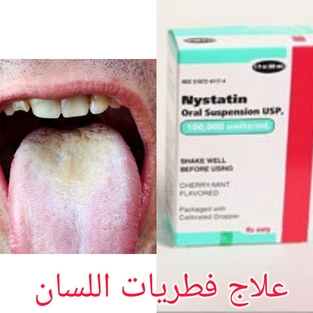 د صالح بن سيف الهنائي On Twitter هل تعاني من الفطريات؟ إليك 4 فطريات
