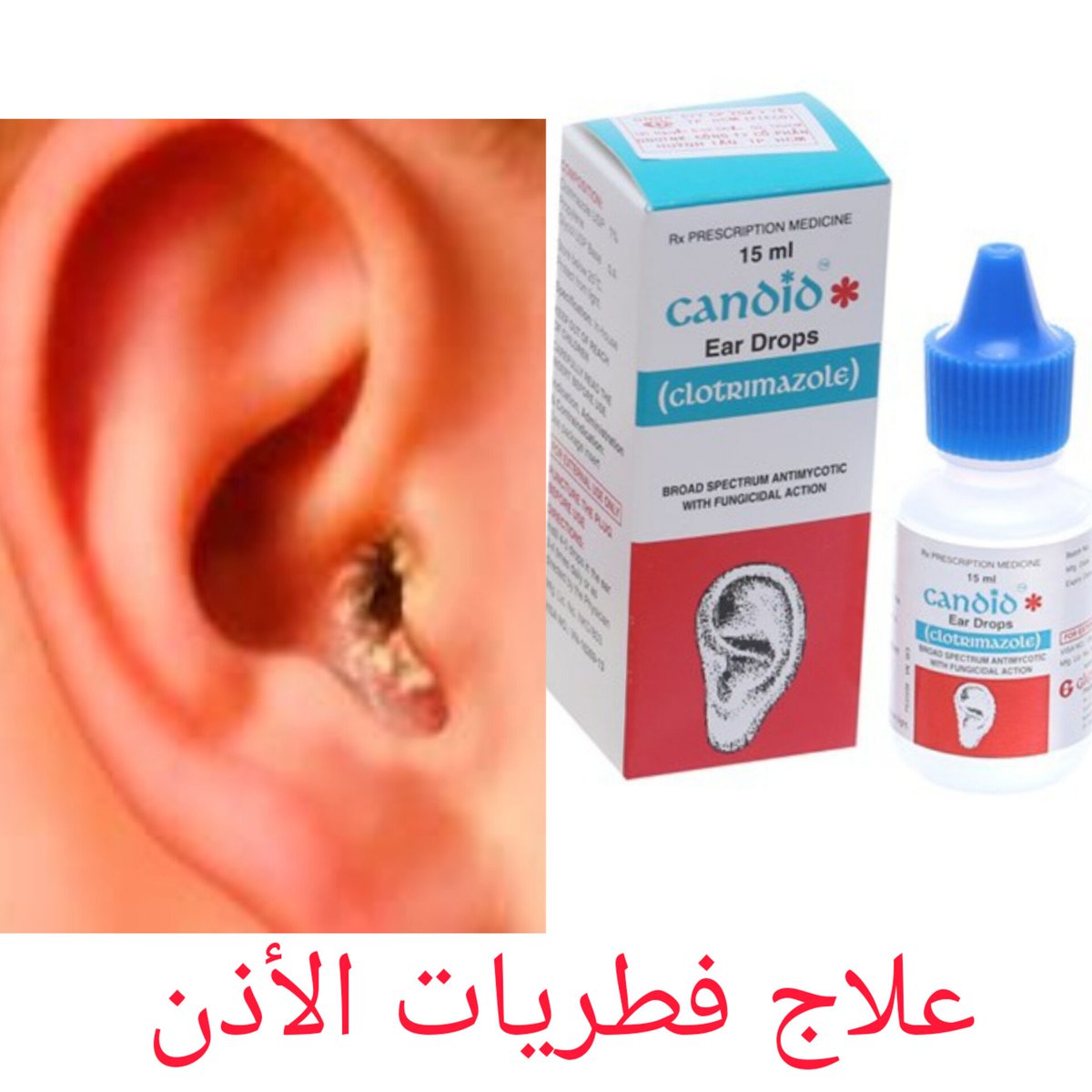 د صالح بن سيف الهنائي On Twitter هل تعاني من الفطريات؟ إليك 4 فطريات