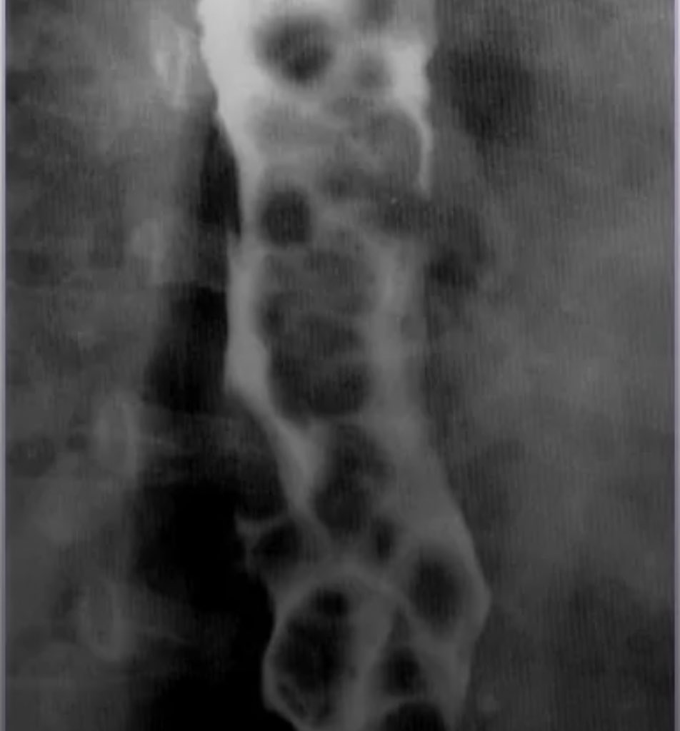 Radrounds Radiology Network On Twitter Whats Your Differential