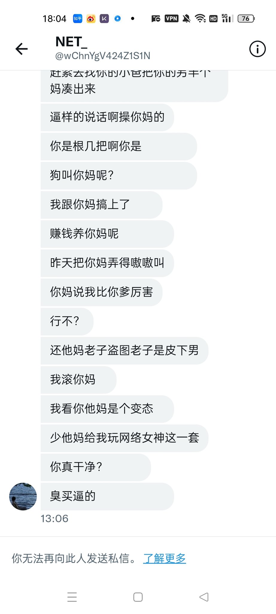 电子恶魔 On Twitter 唉没办法,毕竟这人就只有一根吊了呀 Jgyltuc5vk Twitter