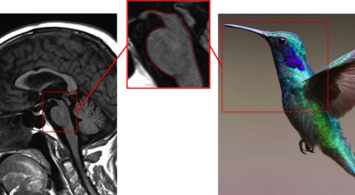 Fantastic animals in the brain!!! “From the tiny tadpole, to the giant ...