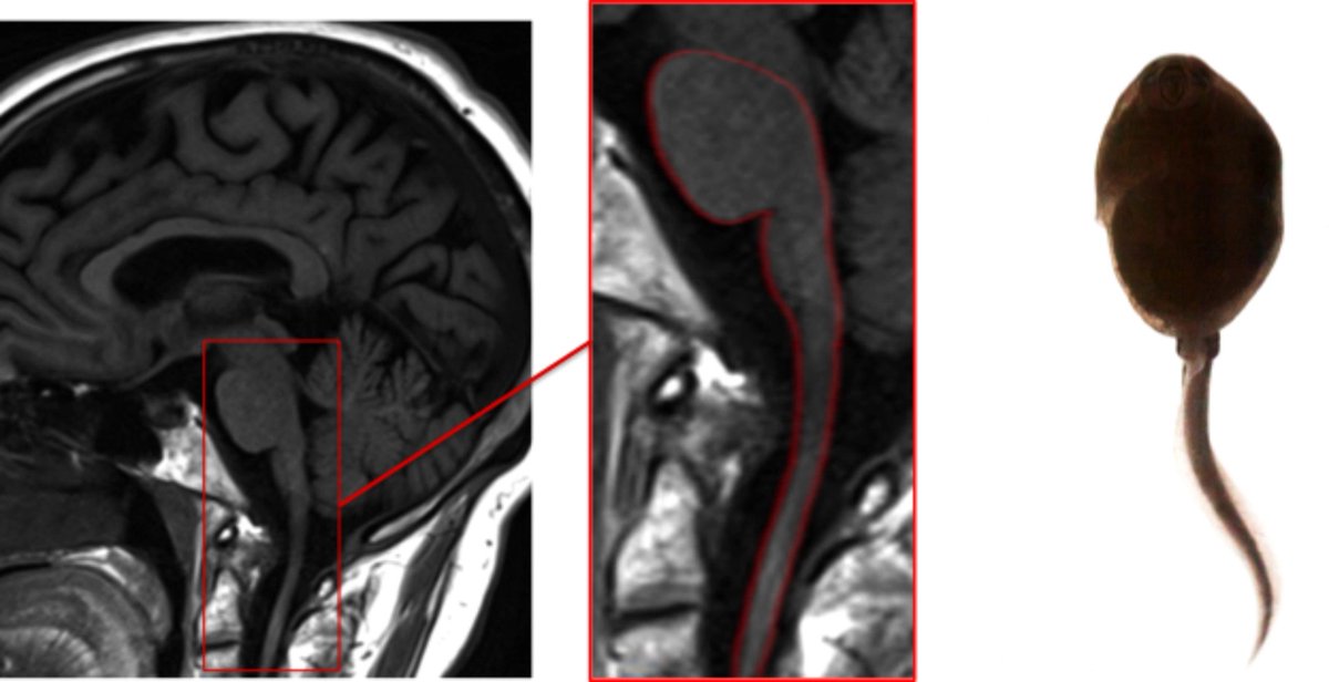 Fantastic animals in the brain!!! “From the tiny tadpole, to the giant ...