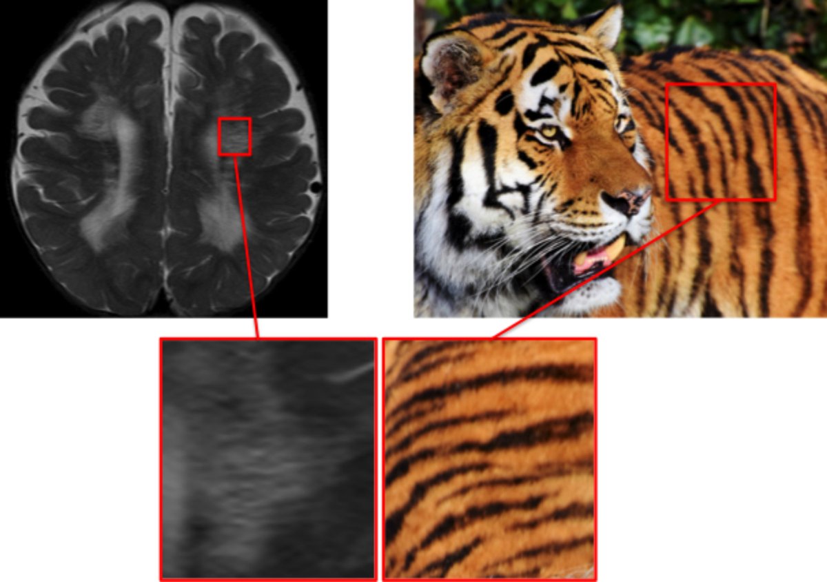 Fantastic animals in the brain!!! “From the tiny tadpole, to the giant ...